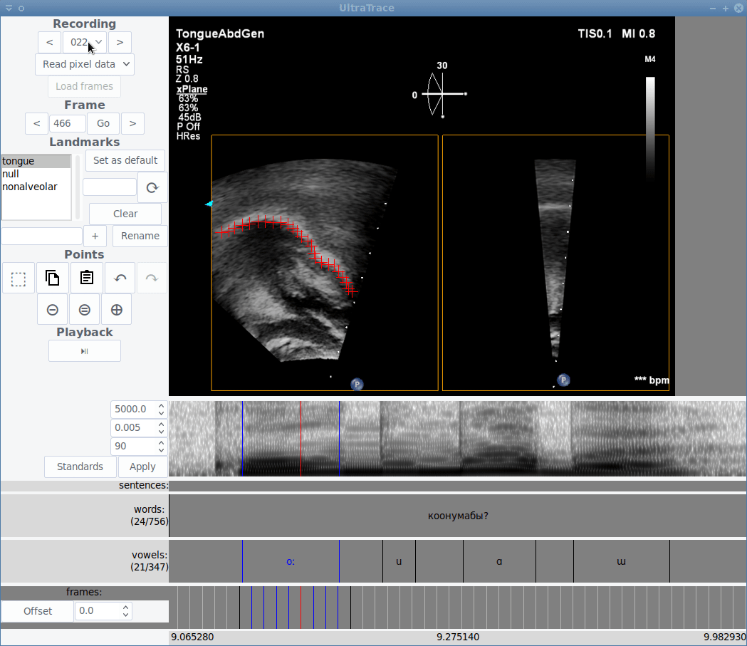 UltraTrace: A free/open-source cross-platform tool for manual ...
