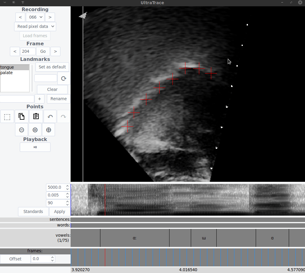 UltraTrace: A free/open-source cross-platform tool for manual ...