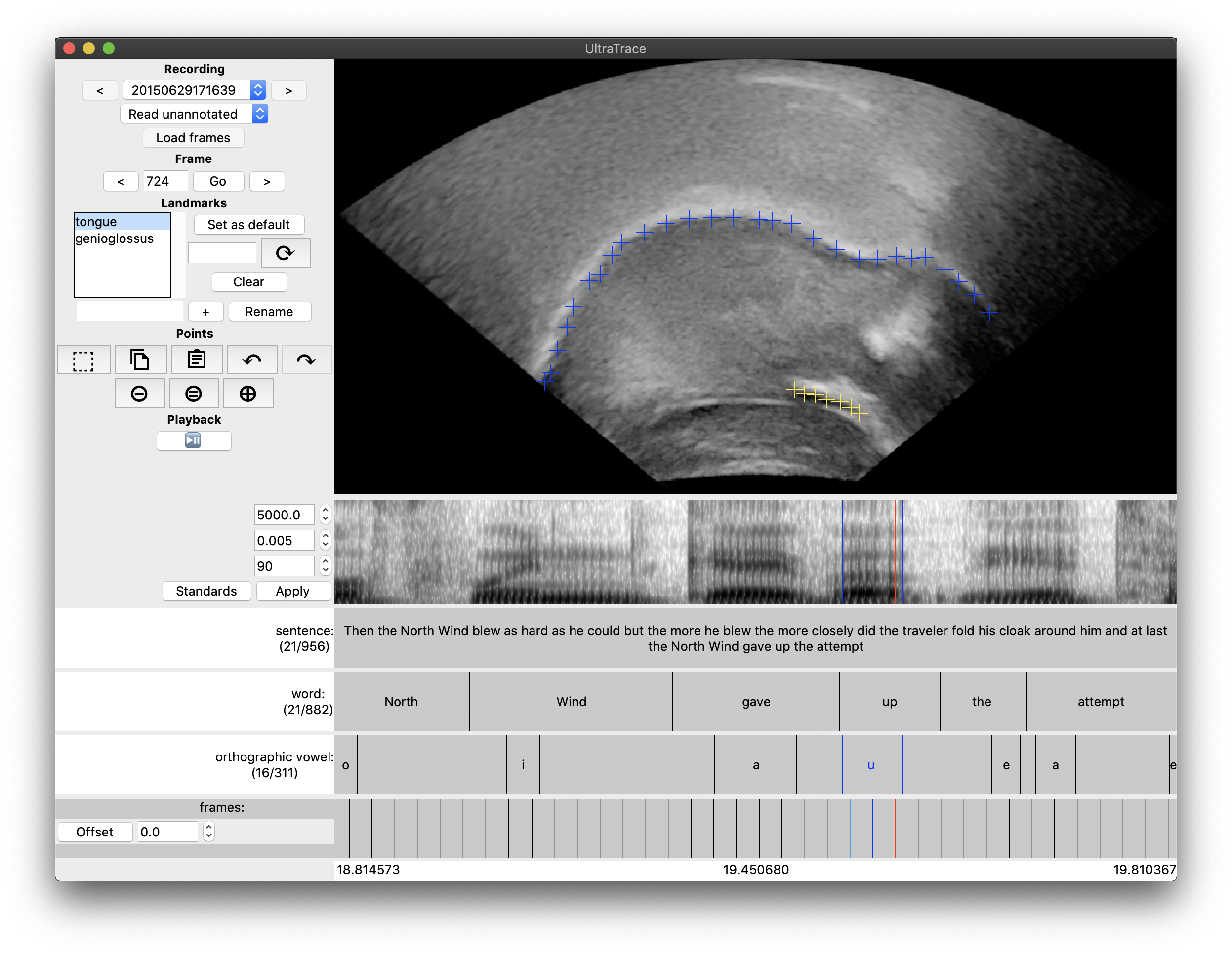 UltraTrace: A free/open-source cross-platform tool for manual ...